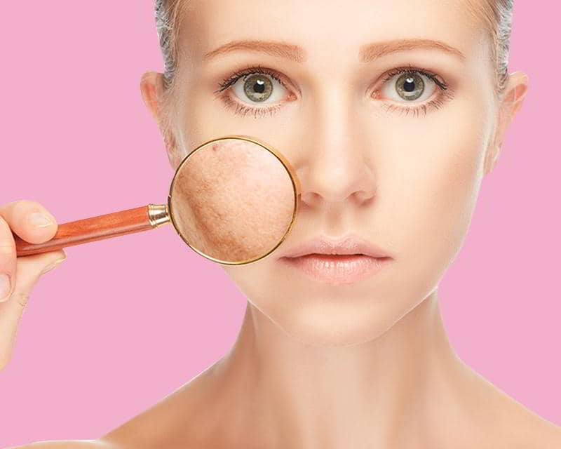Understanding Pigmentation and How a Pigmentation Removal Clinic Can ...
